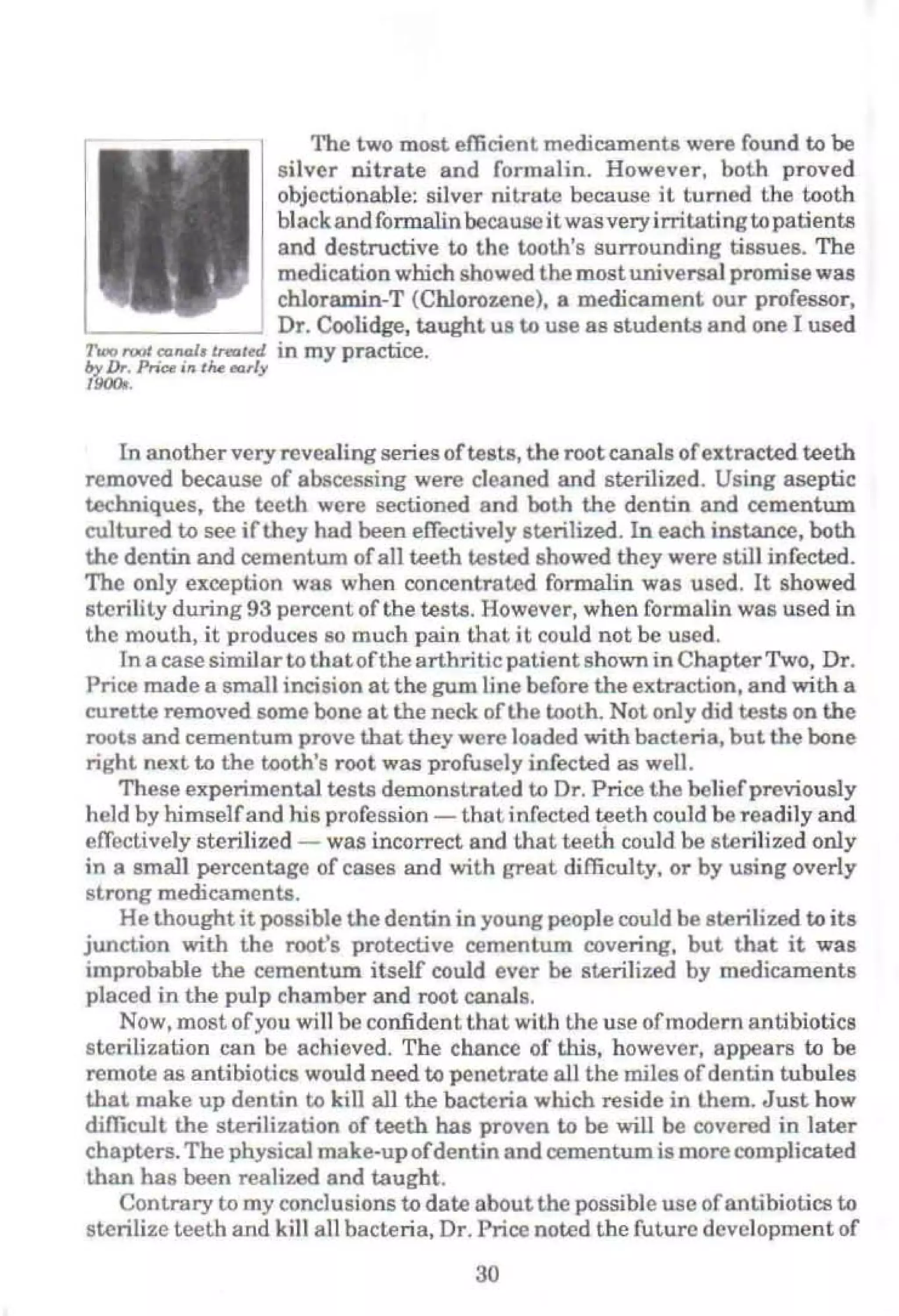 Root canal cover up 1996 | PDF
