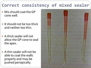 Root Canal Sealers | PPTX