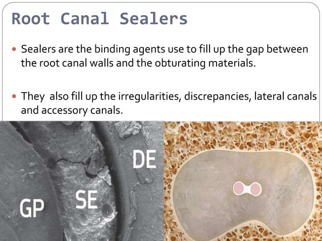 Root Canal Sealers | PPTX | Dental Health | Diseases and Conditions