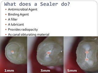 Root Canal Sealers | PPTX