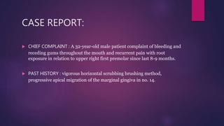 Root Amputation and Perio Esthetic Surgery | PPTX