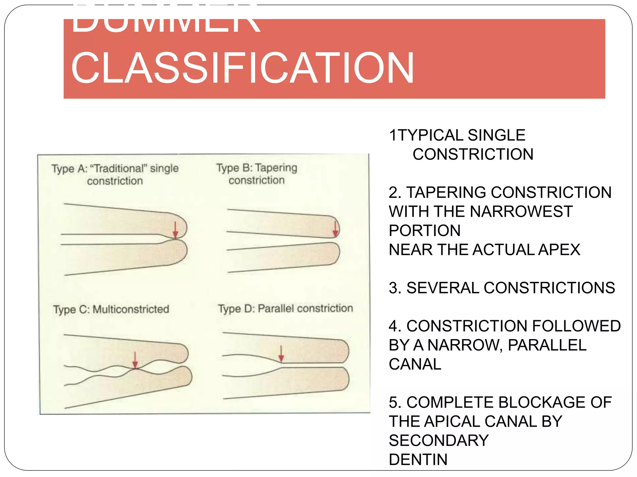 Root apex and working length determination | PPTX