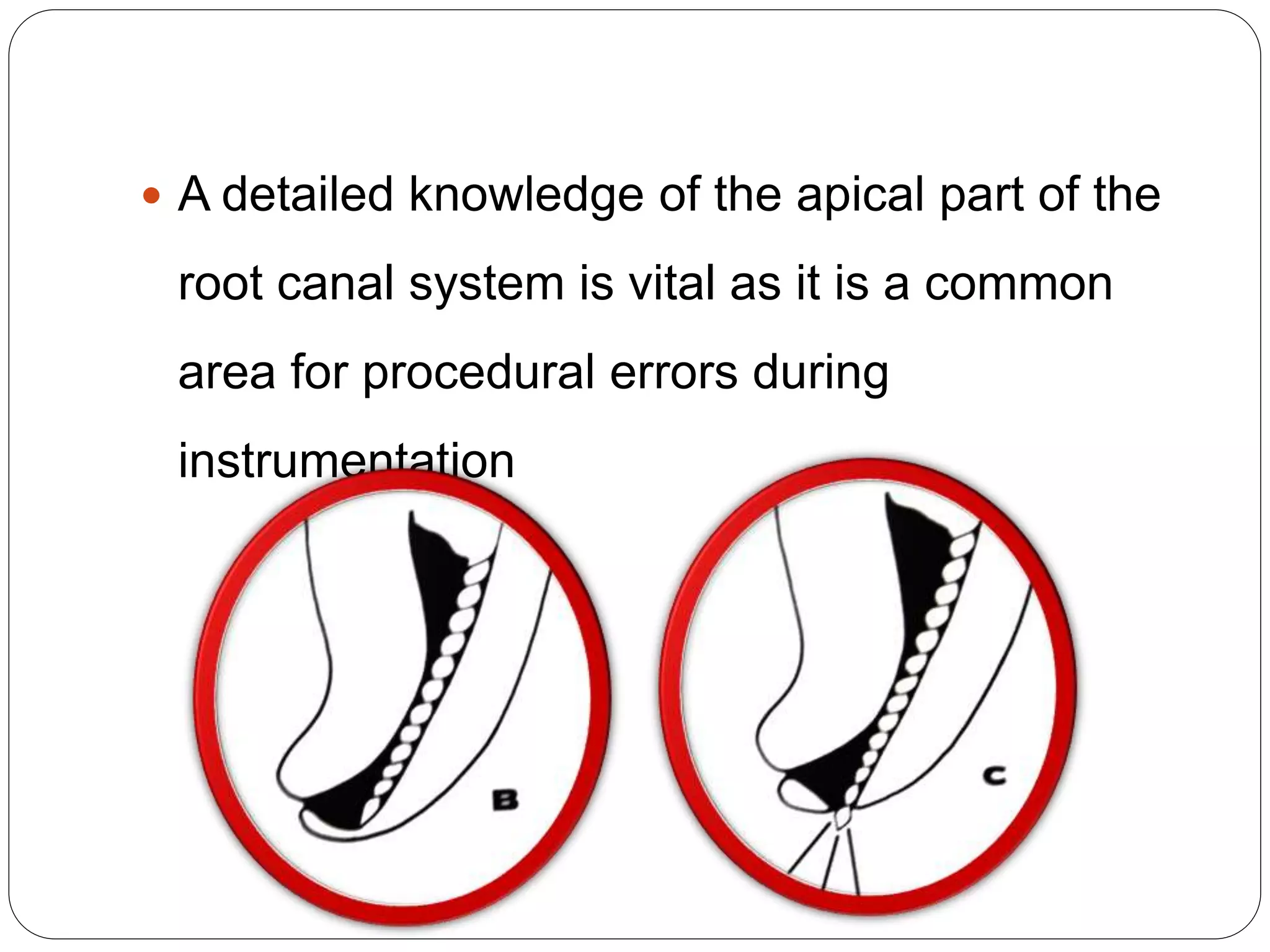 Root apex and working length determination | PPTX