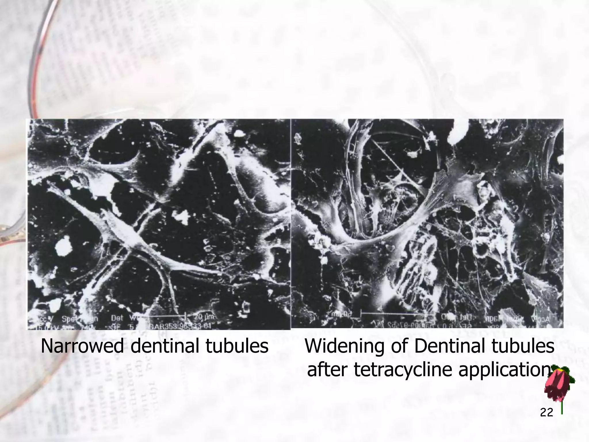 Root biomodification | PPTX