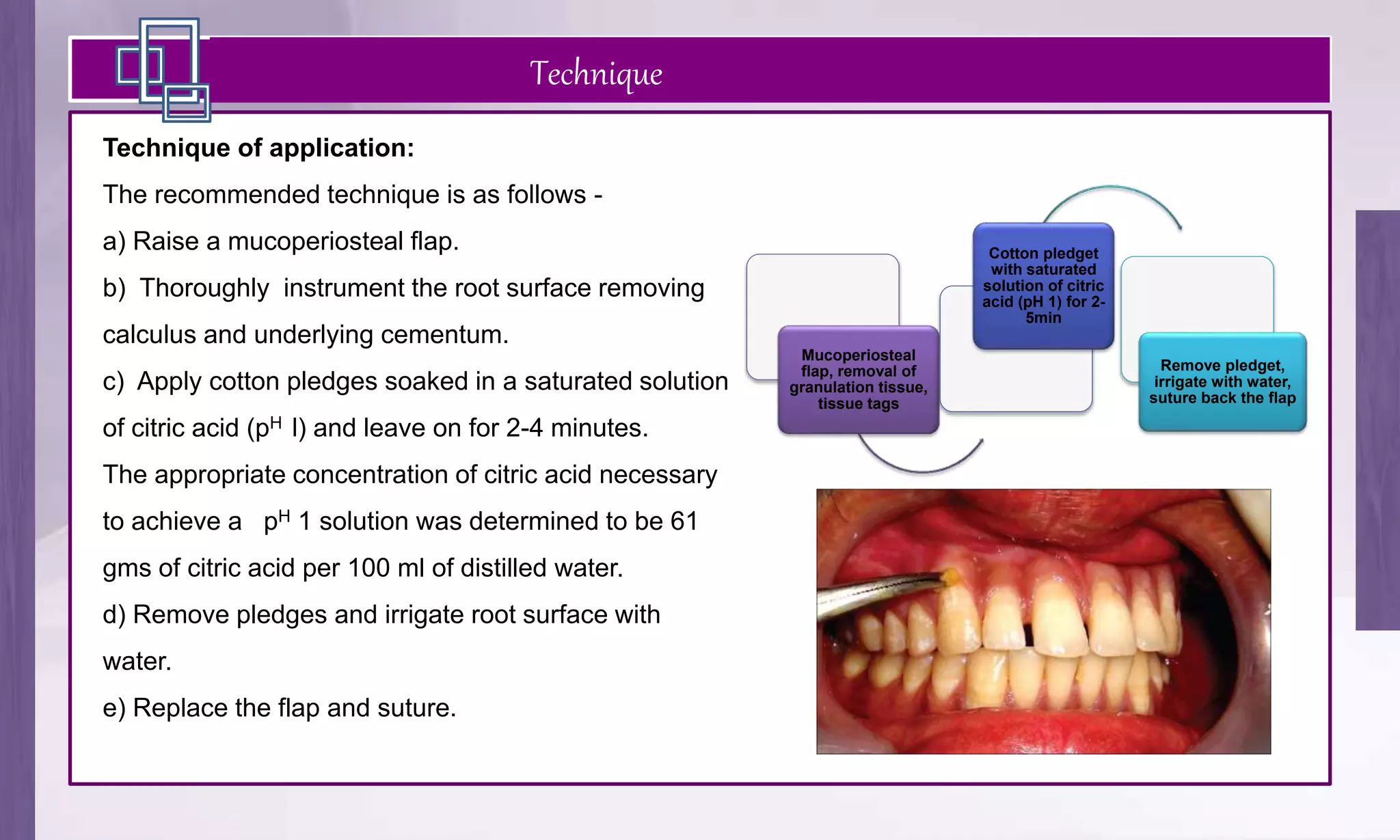 Root biomodification | PPT