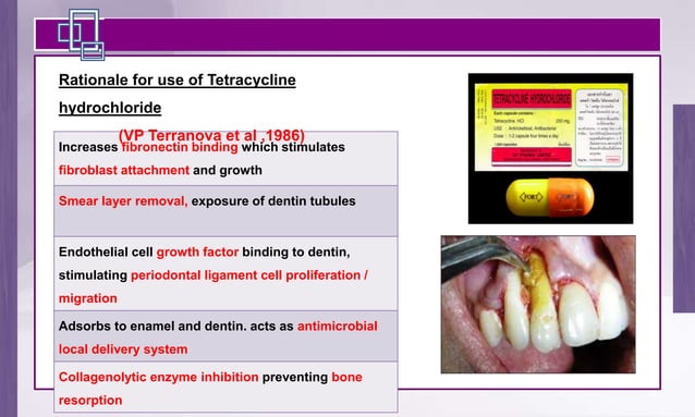 Root biomodification | PPT