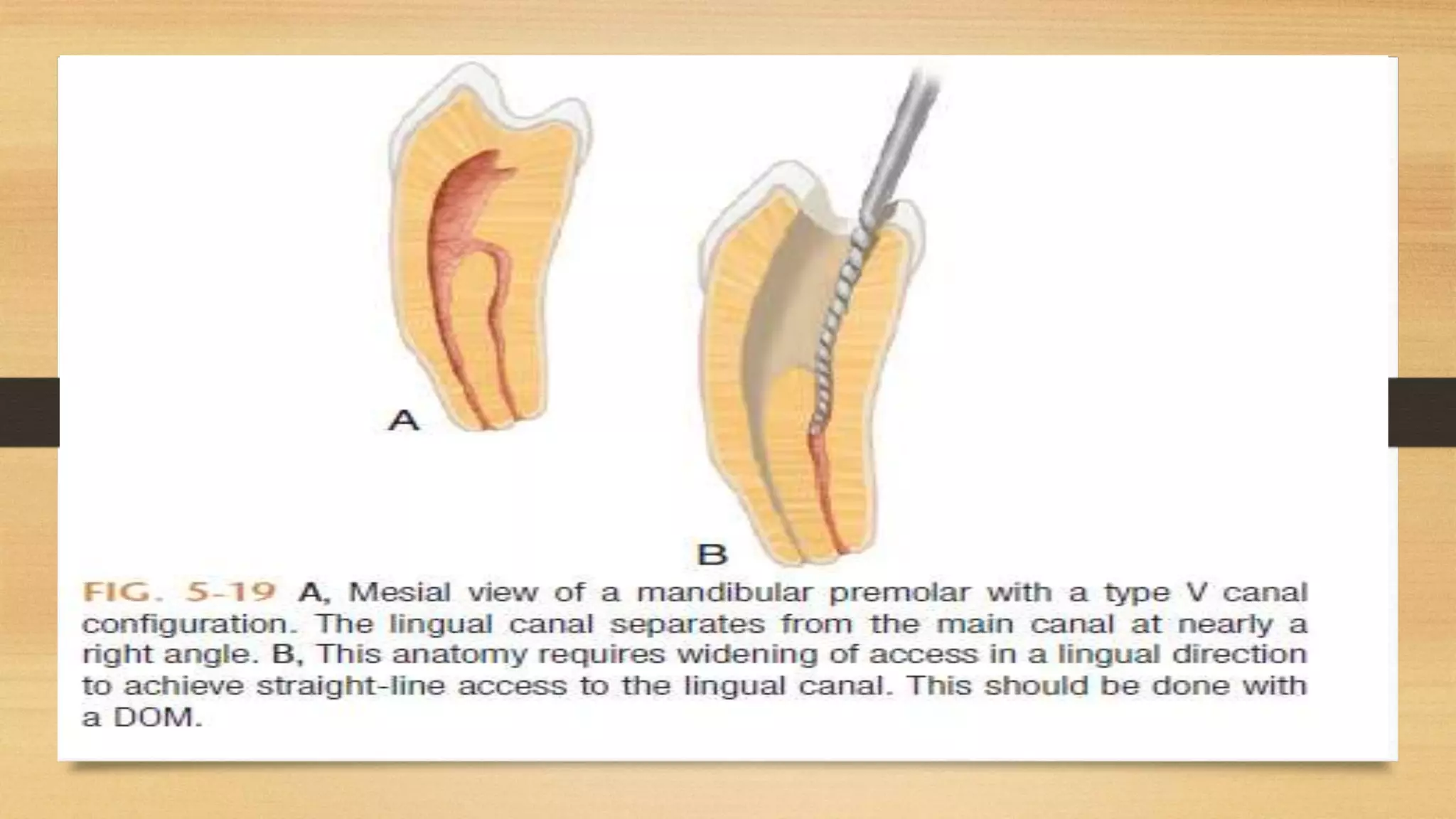 Root canal anatomy | PPTX