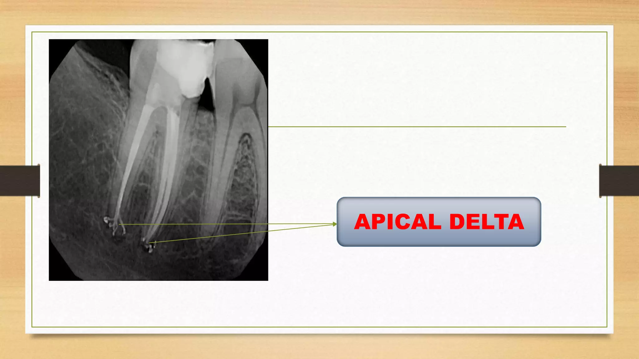 Root canal anatomy | PPTX