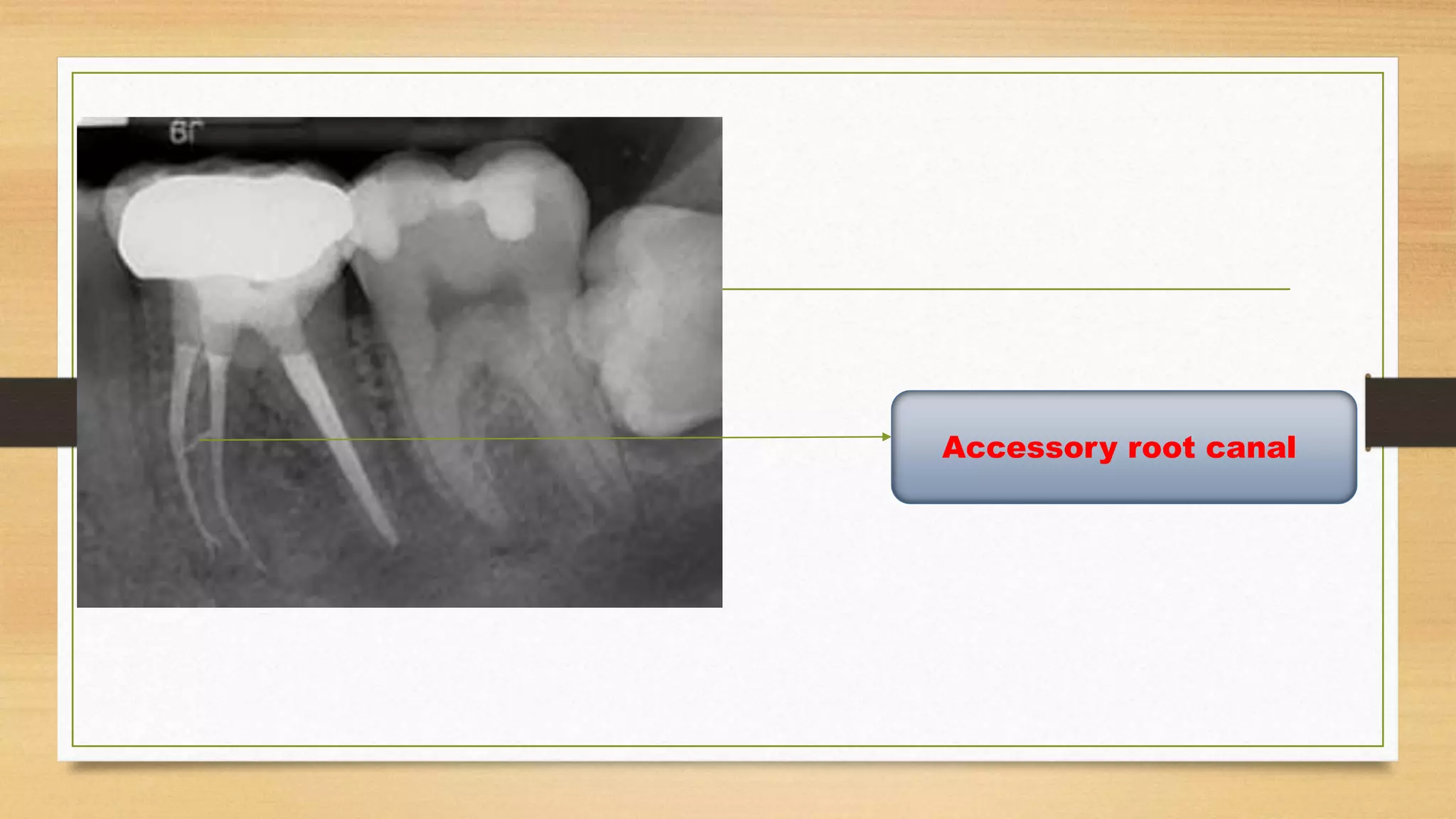 Root canal anatomy | PPTX