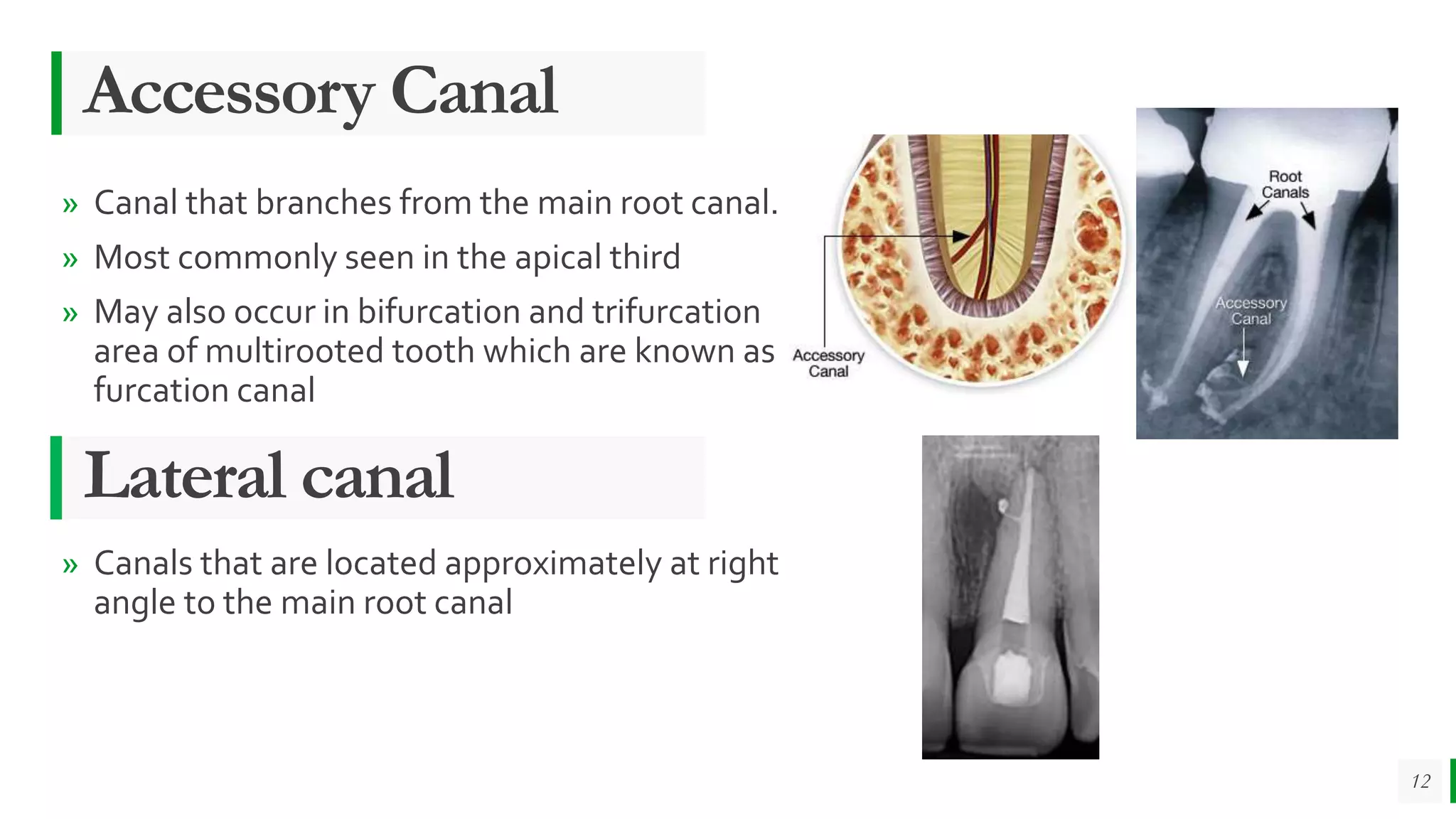 Root Canal Anatomy Ppt