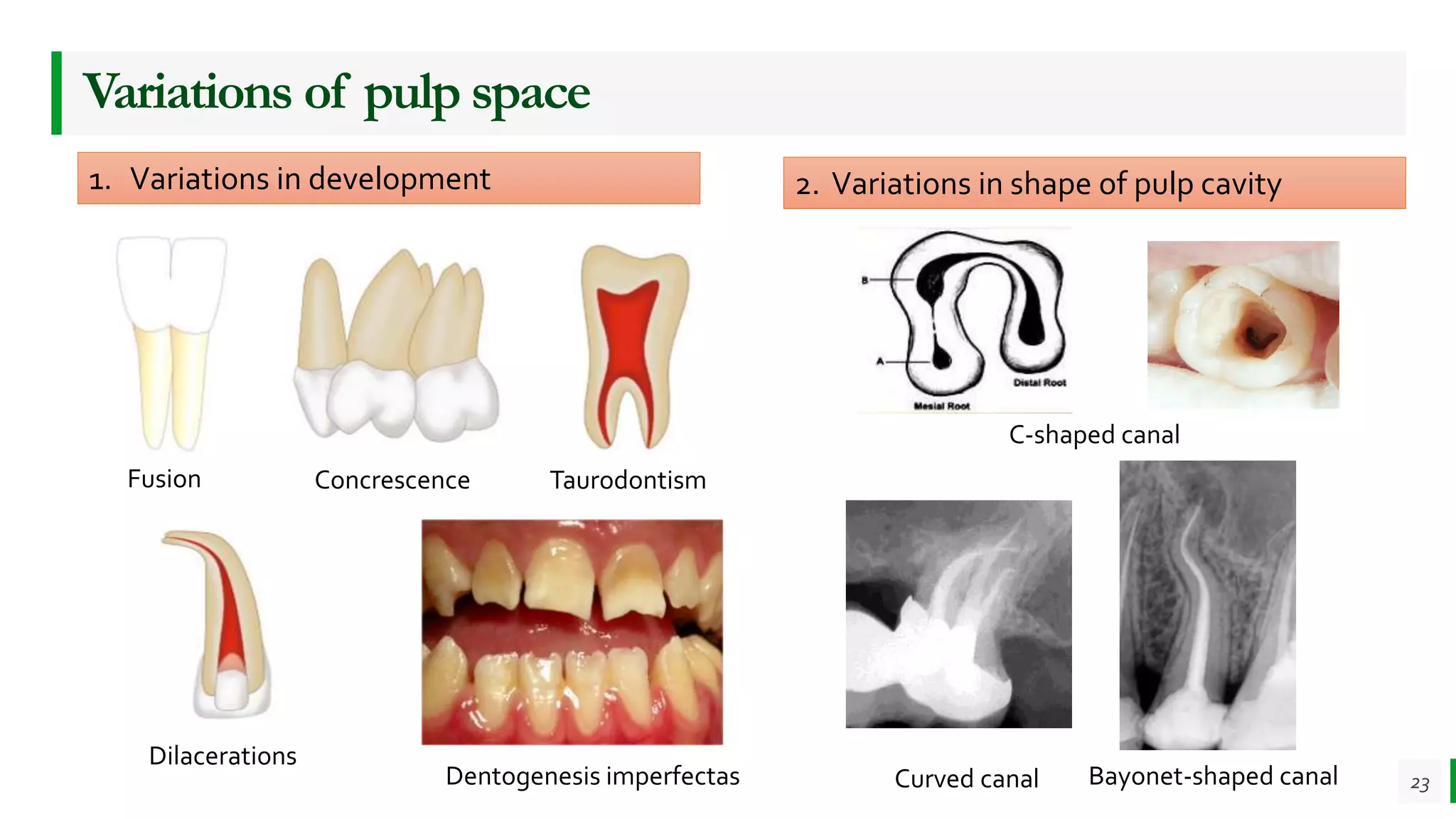 Root canal anatomy | PPTX