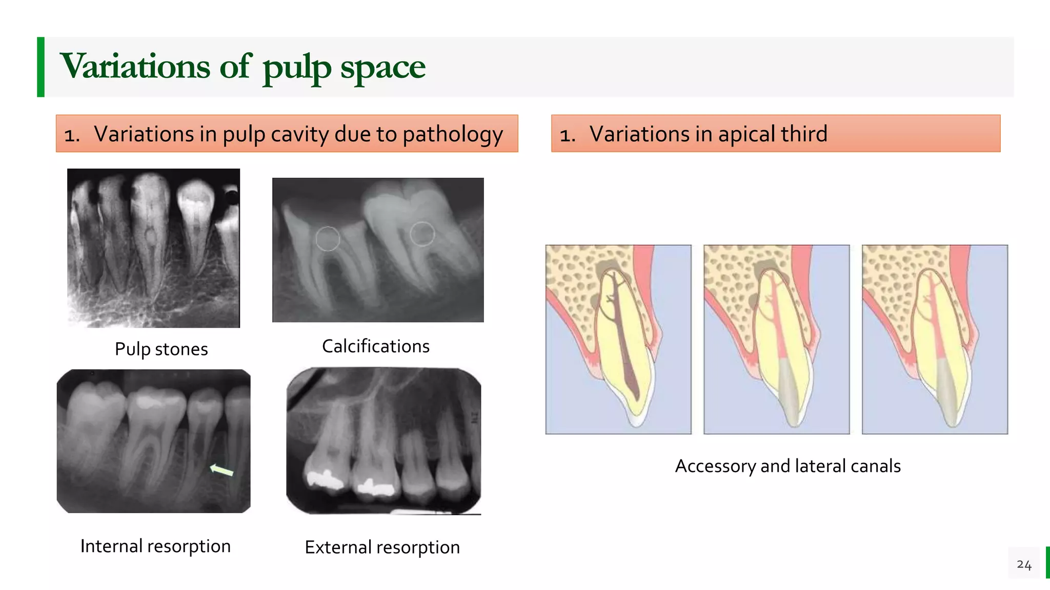 Root canal anatomy | PPTX