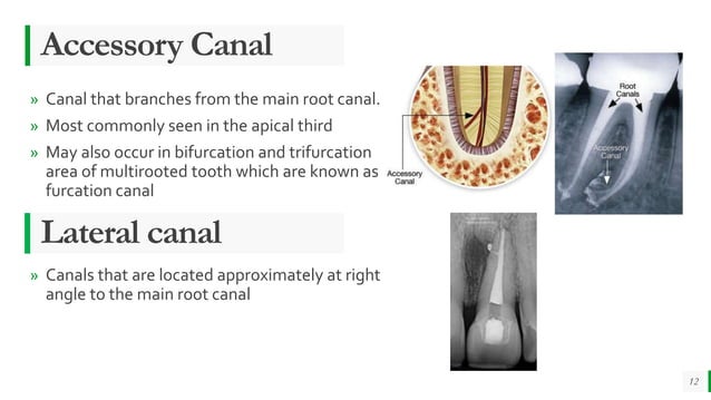 Root canal anatomy | PPTX | Dental Health | Diseases and Conditions