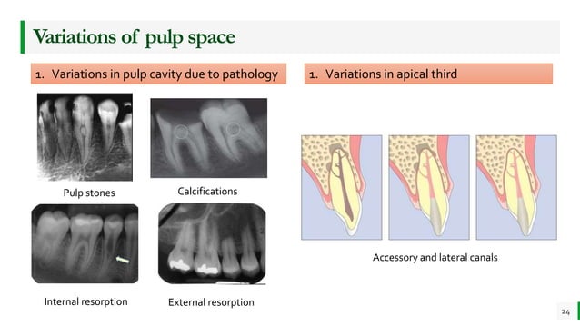 Root canal anatomy | PPTX | Dental Health | Diseases and Conditions