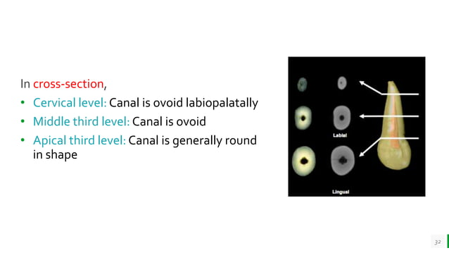 Root canal anatomy | PPTX | Dental Health | Diseases and Conditions