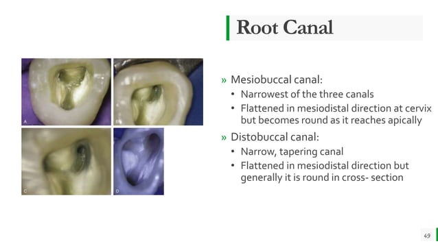 Root canal anatomy | PPTX | Dental Health | Diseases and Conditions