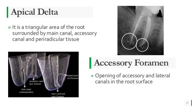 Root canal anatomy