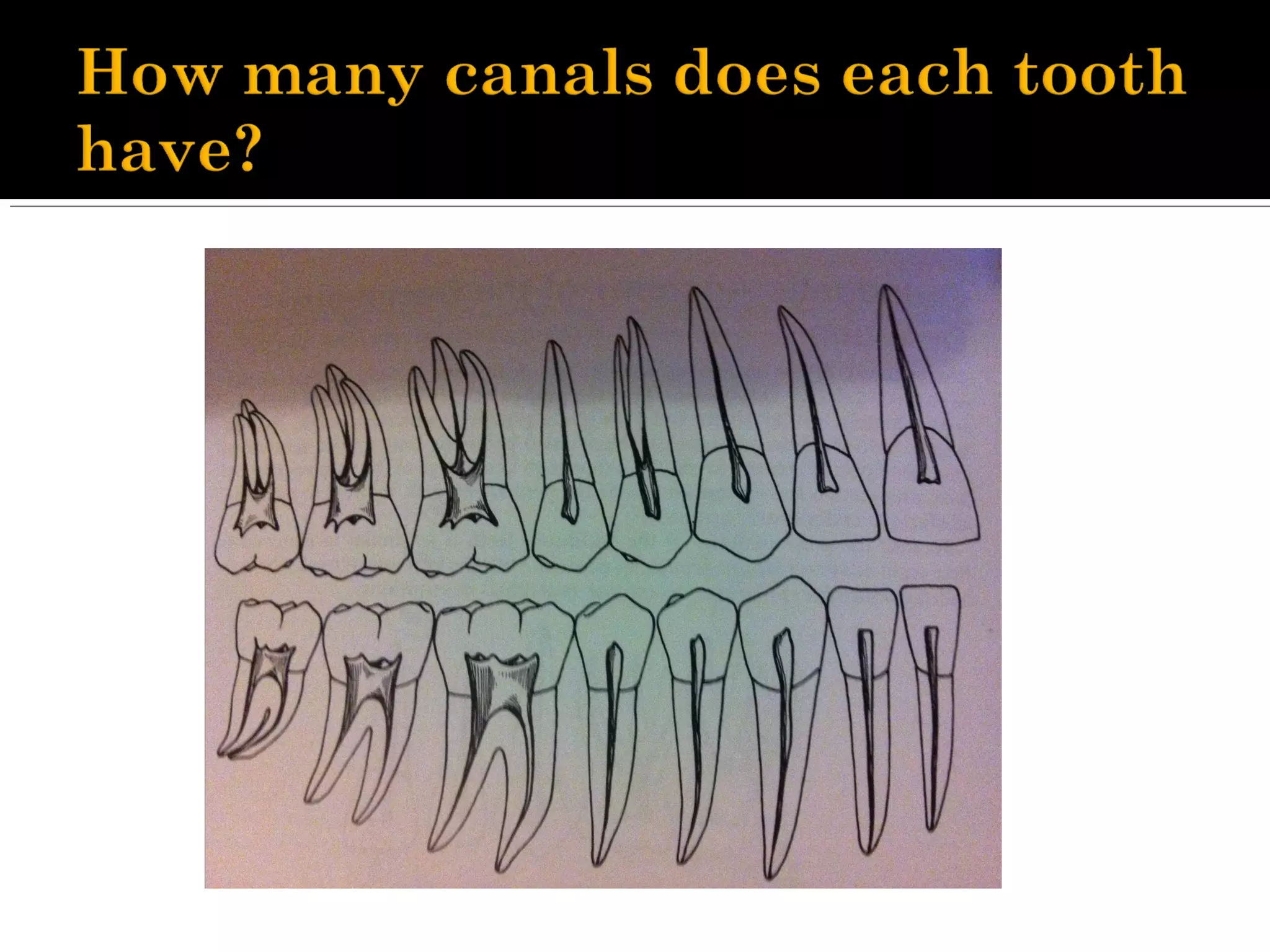 Root canal anatomy and access cavities | PPT