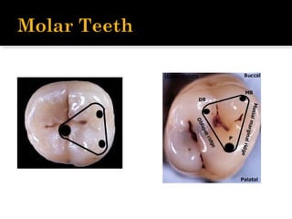 Root canal anatomy and access cavities | PPT