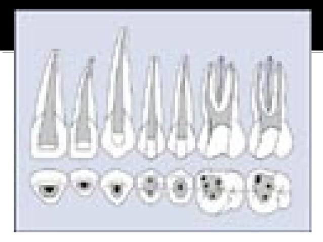 Root canal anatomy and access cavities | PPT
