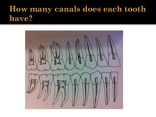 Root canal anatomy and access cavities