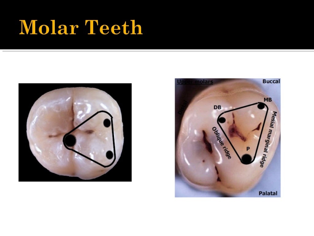 Root Canal Anatomy And Access Cavities