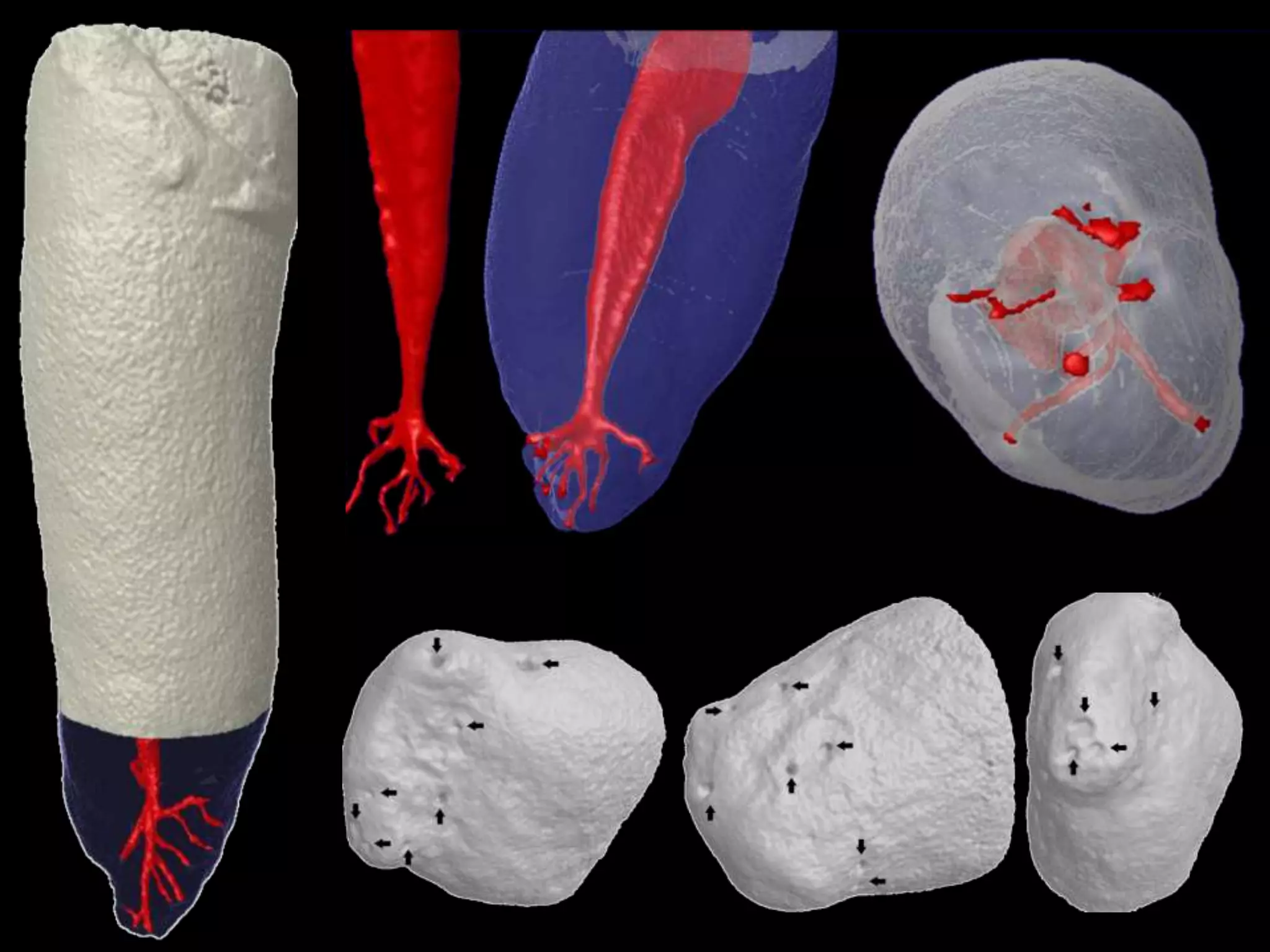 Root canal anatomy and configuration project mandibular teeth ...