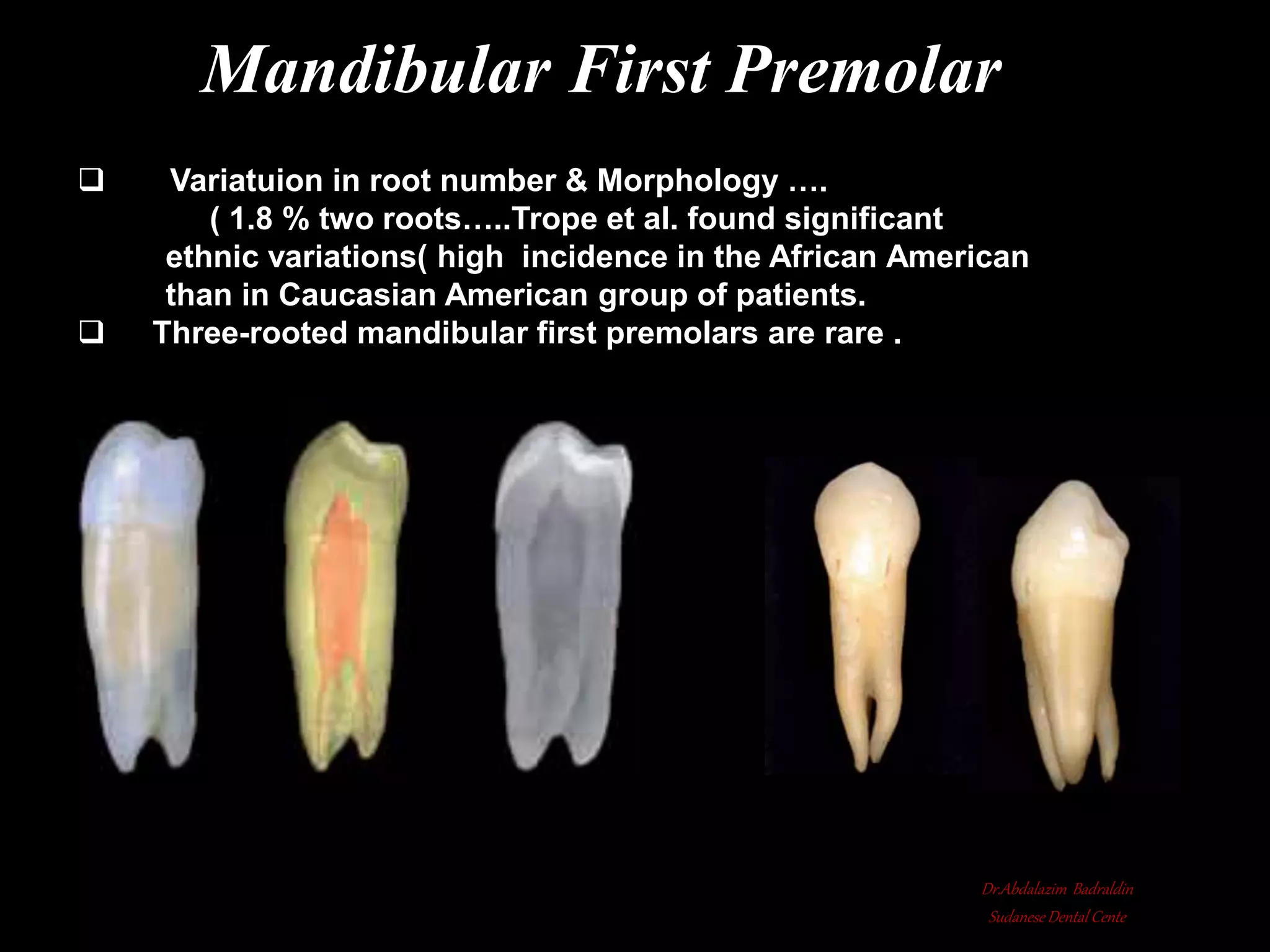 Root canal anatomy and configuration project mandibular teeth ...