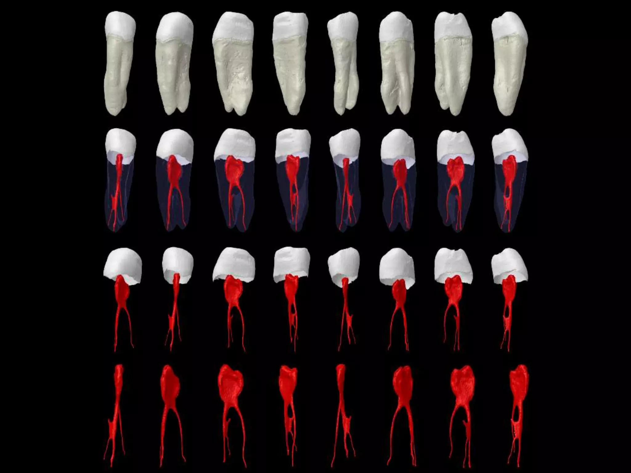 Root canal anatomy and configuration project mandibular teeth ...