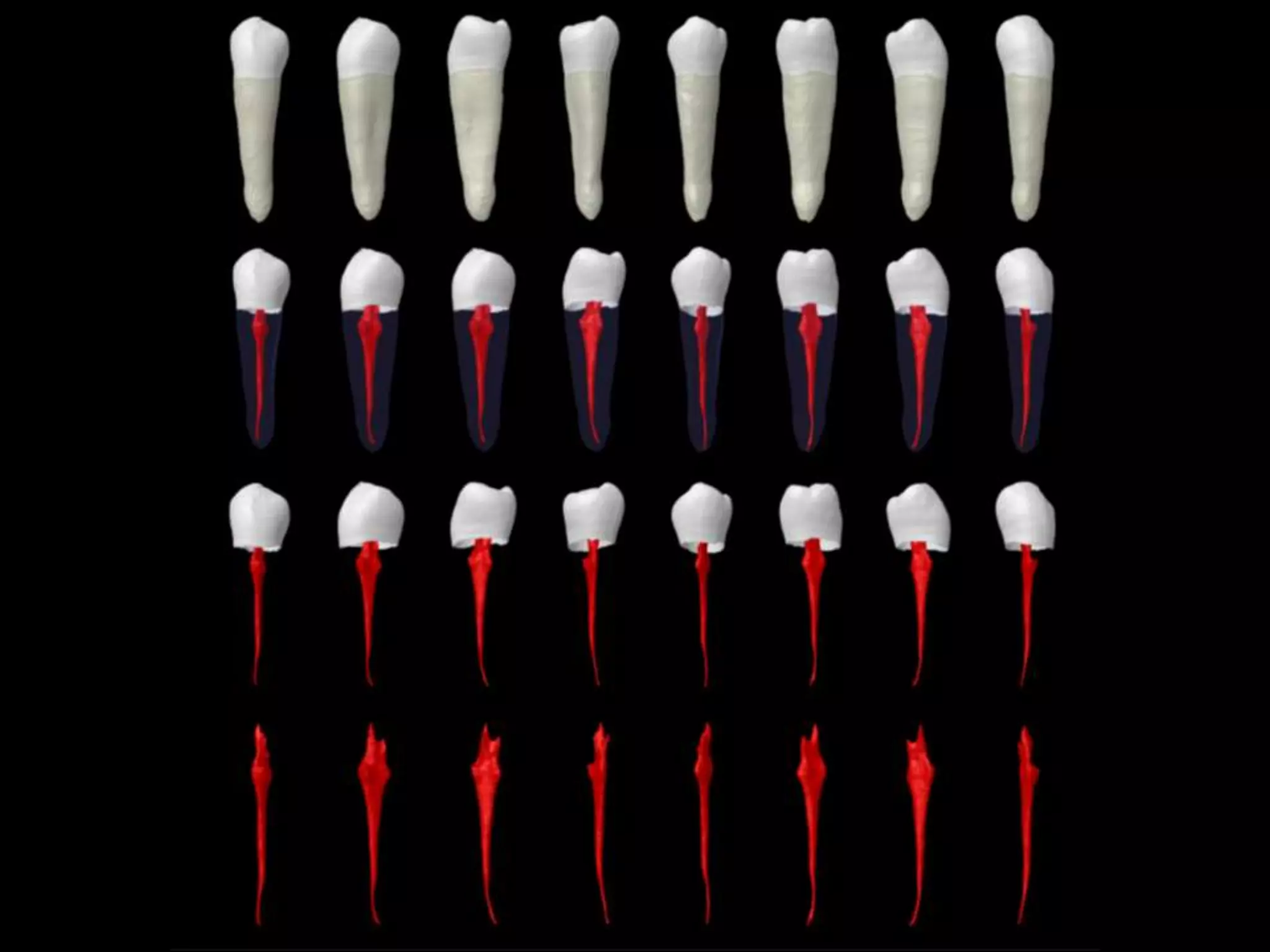 Root canal anatomy and configuration project mandibular teeth ...