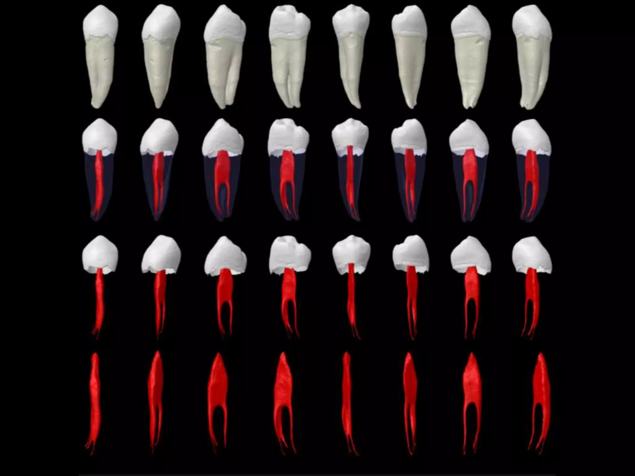 Root canal anatomy and configuration project mandibular teeth ...