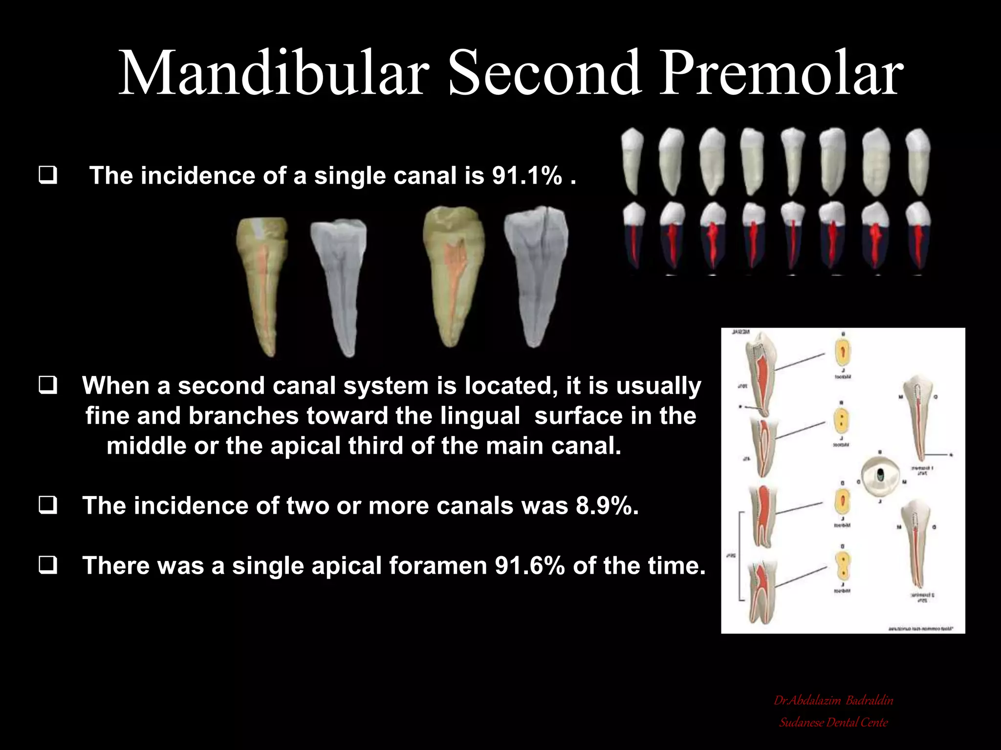 Root canal anatomy and configuration project mandibular teeth ...