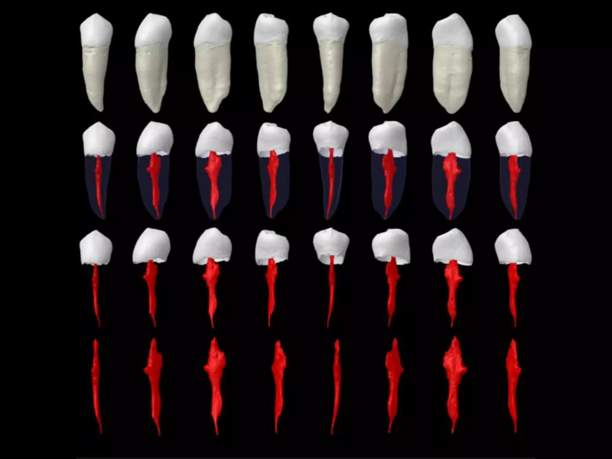 Root canal anatomy and configuration project mandibular teeth ...