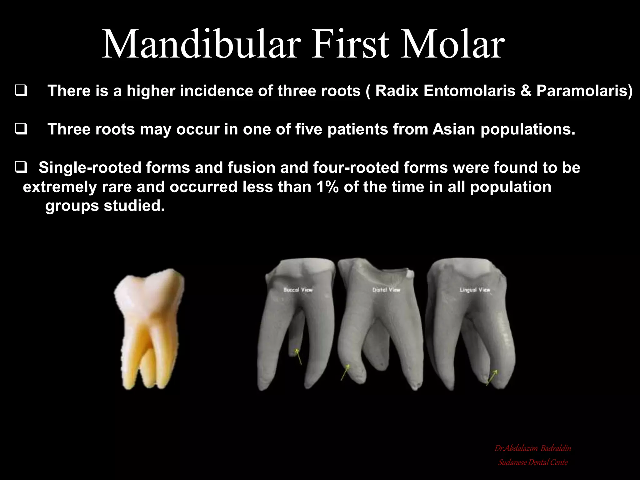 Root canal anatomy and configuration project mandibular teeth ...