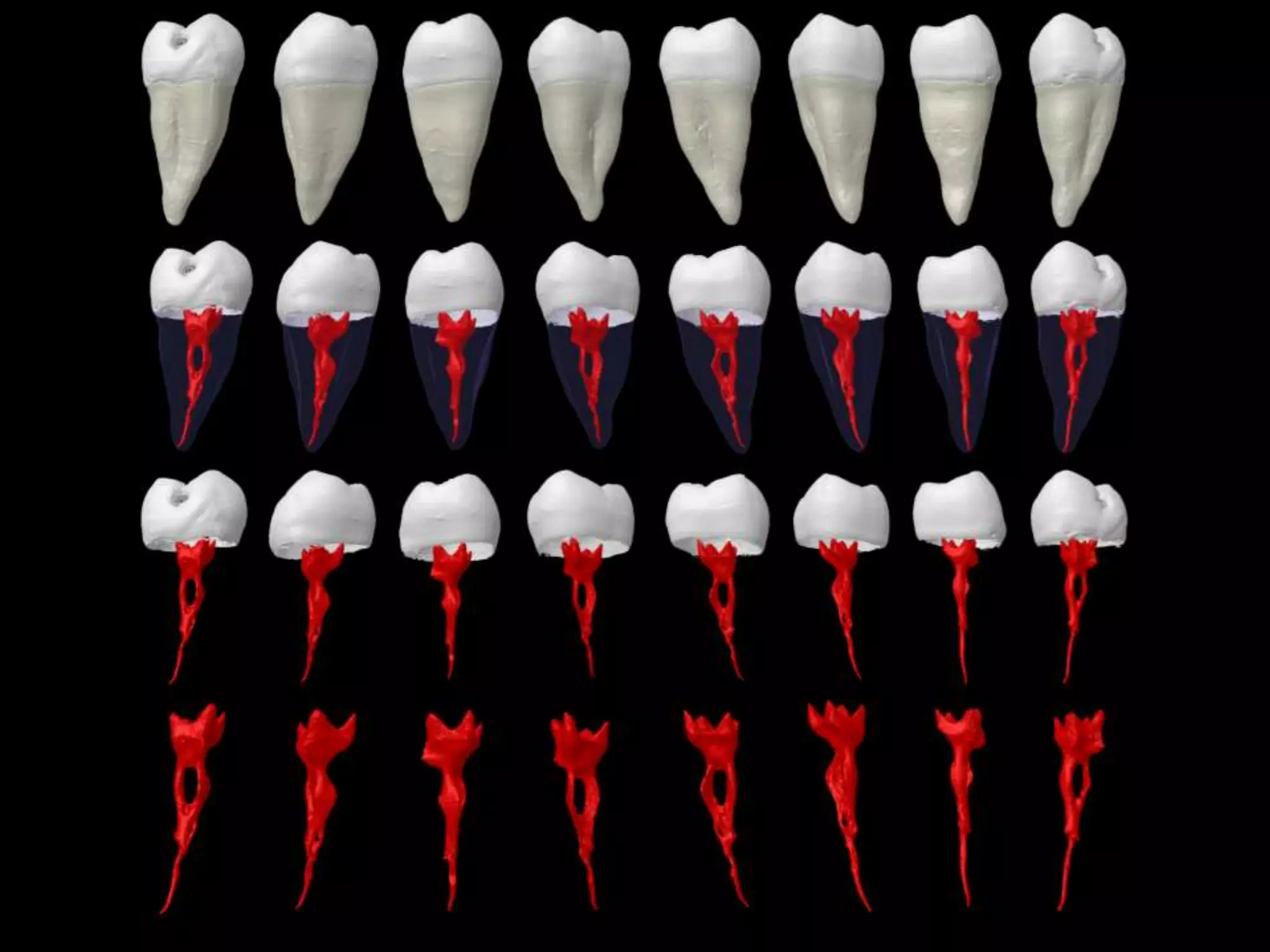 Root canal anatomy and configuration project mandibular teeth ...