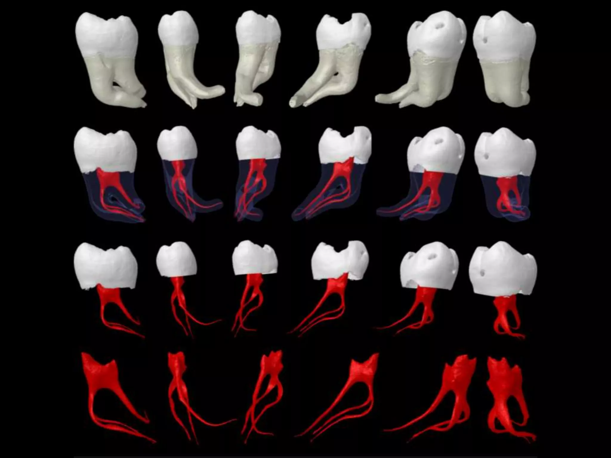 Root canal anatomy and configuration project mandibular teeth ...