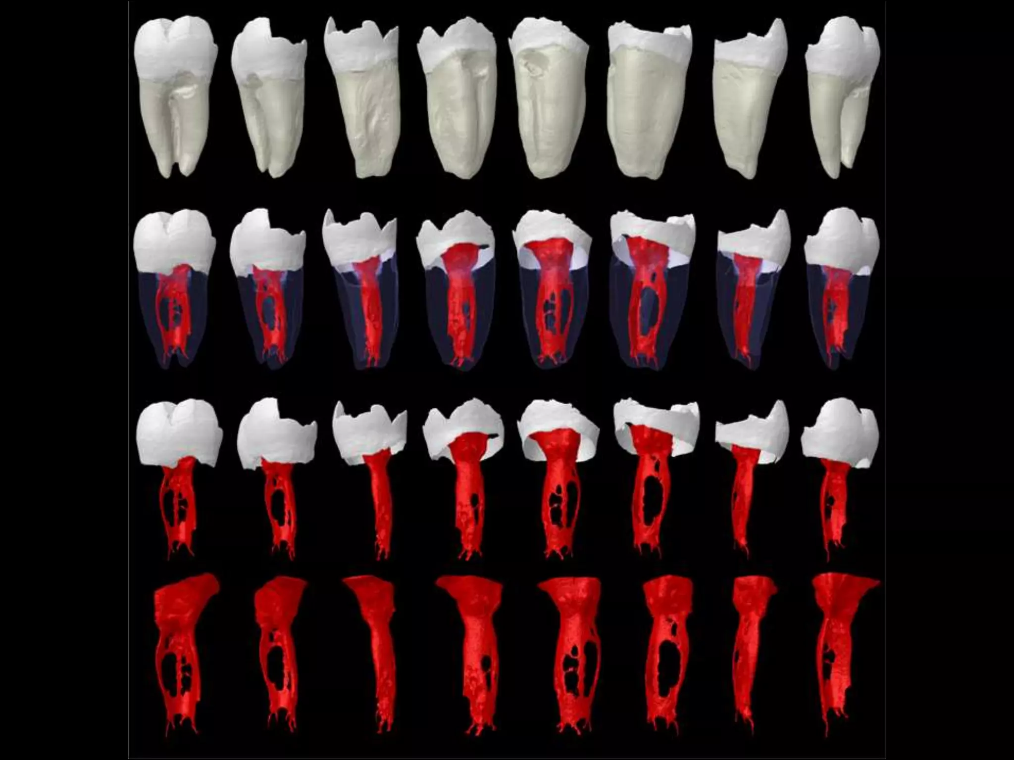 Root canal anatomy and configuration project mandibular teeth ...