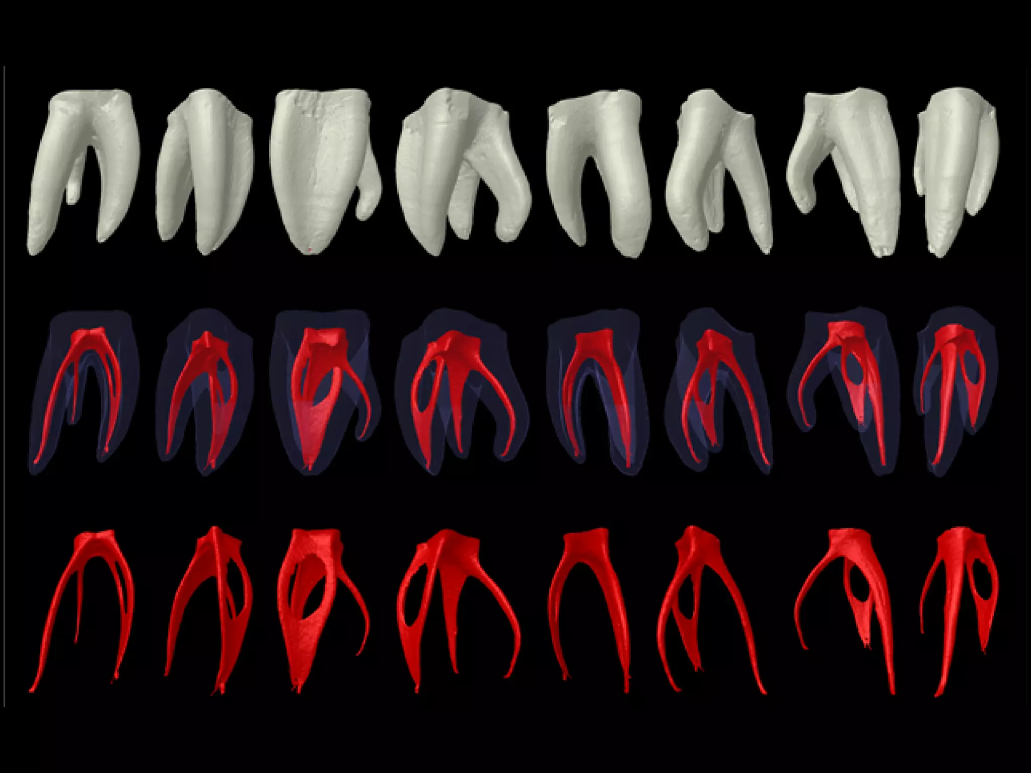 Root canal anatomy and configuration project mandibular teeth ...