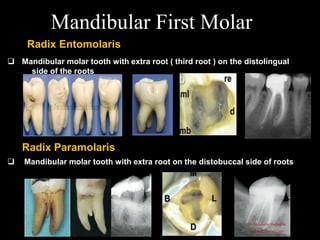 Root canal anatomy and configuration project mandibular teeth ...