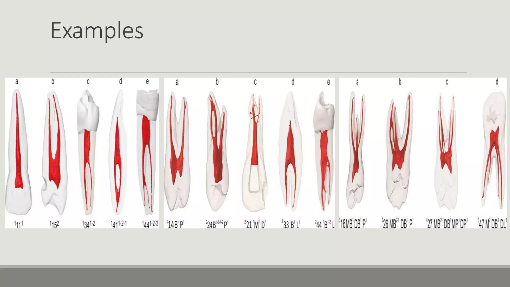 Root canal anatomy for anterior teeth | PPTX
