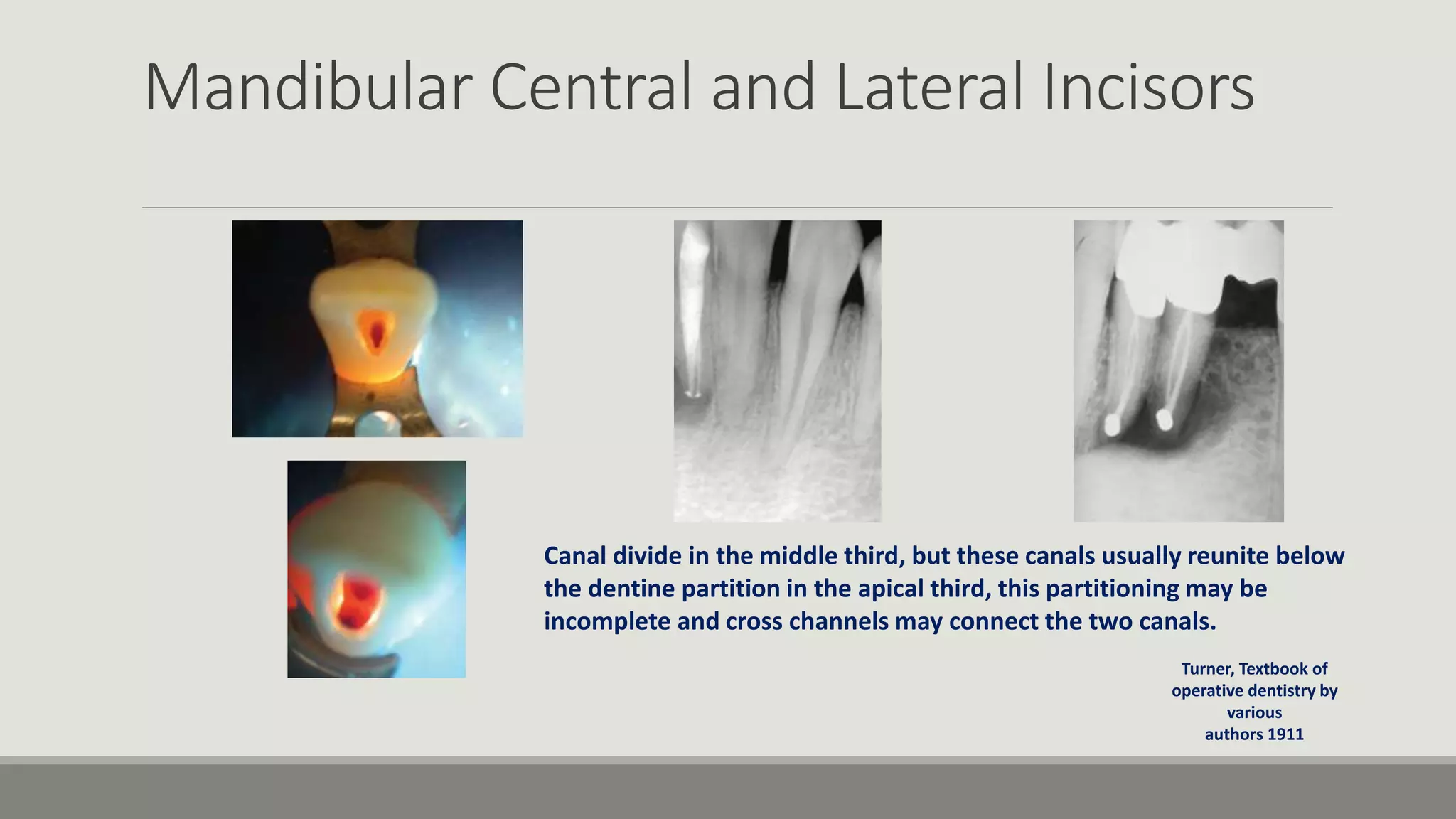 Root canal anatomy for anterior teeth | PPTX