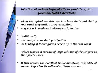 Root canal irrigants and devices | PPT