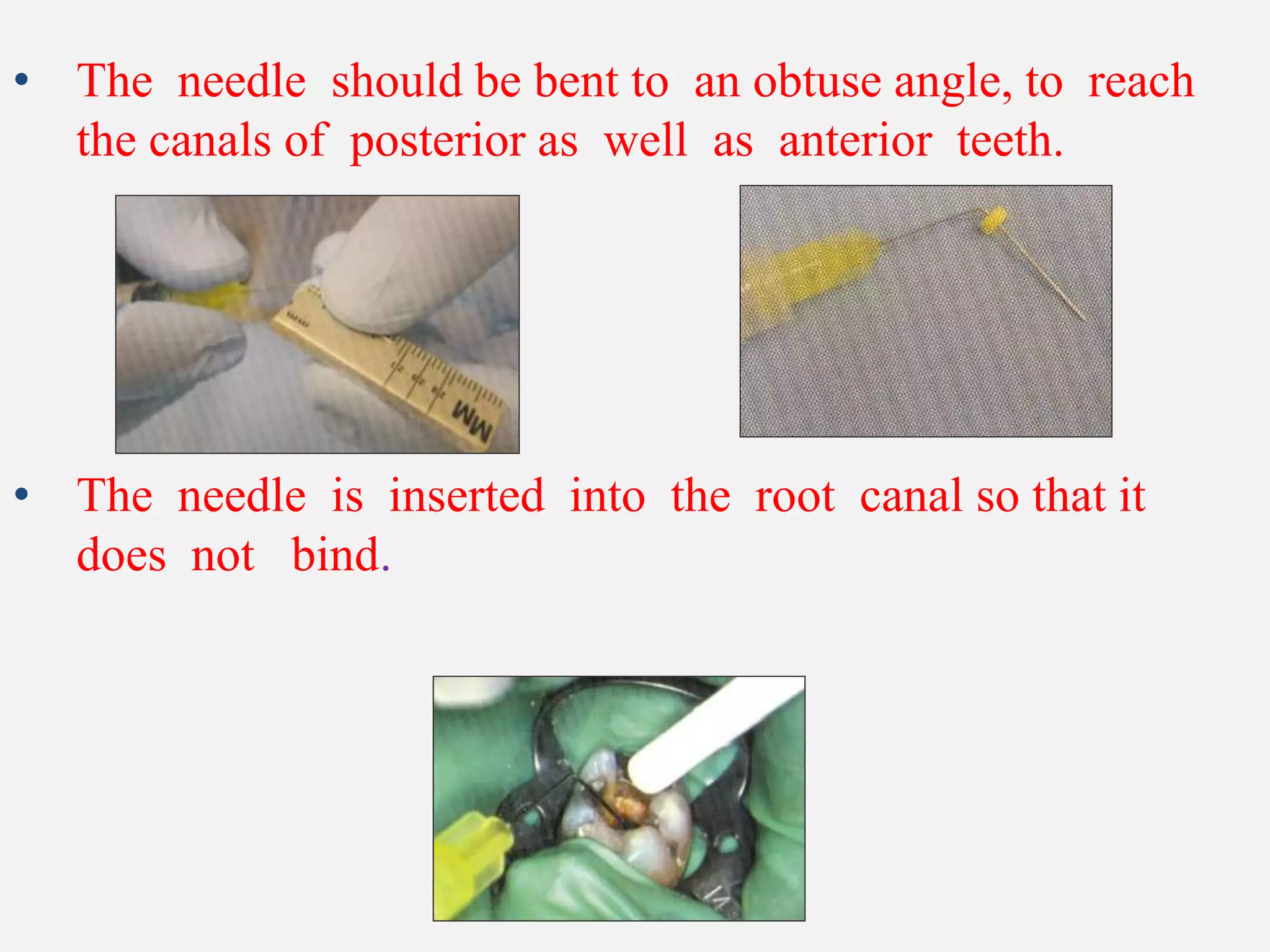 Root canal Irrigation.pptx