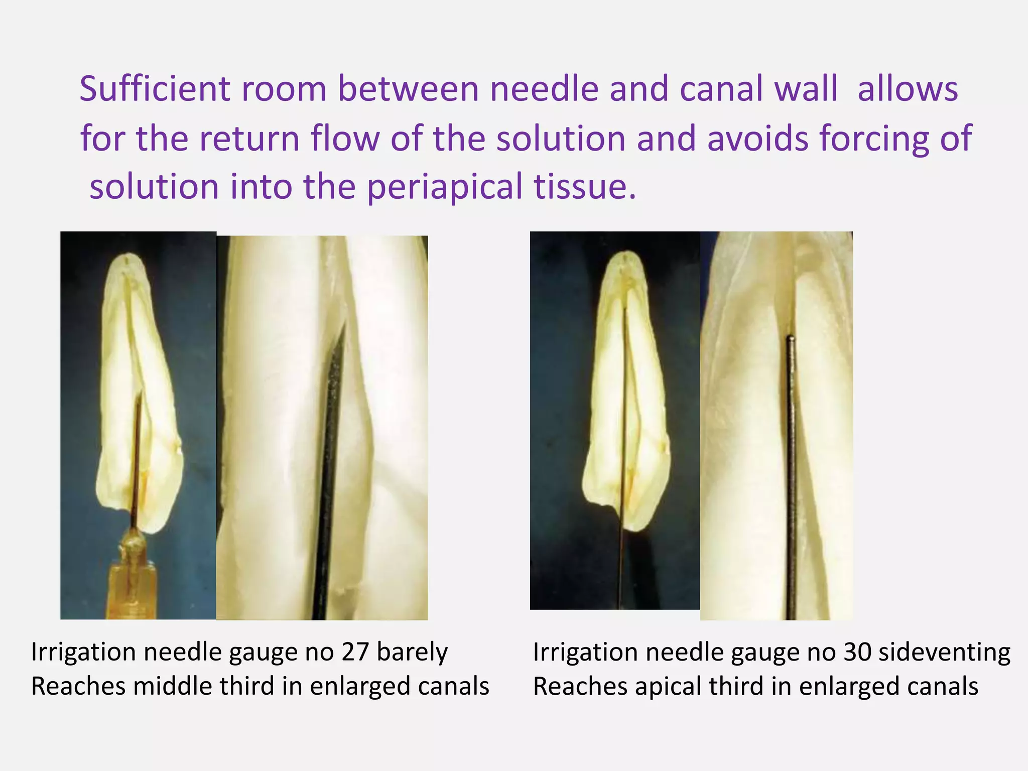 Root canal Irrigation.pptx