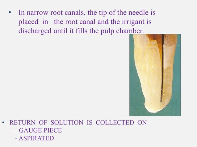 Root canal Irrigation.pptx | First Aid | Injuries