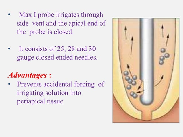 Root canal Irrigation.pptx | First Aid | Injuries