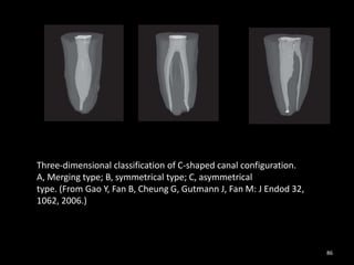 Root canal morphology nidhi | PPTX