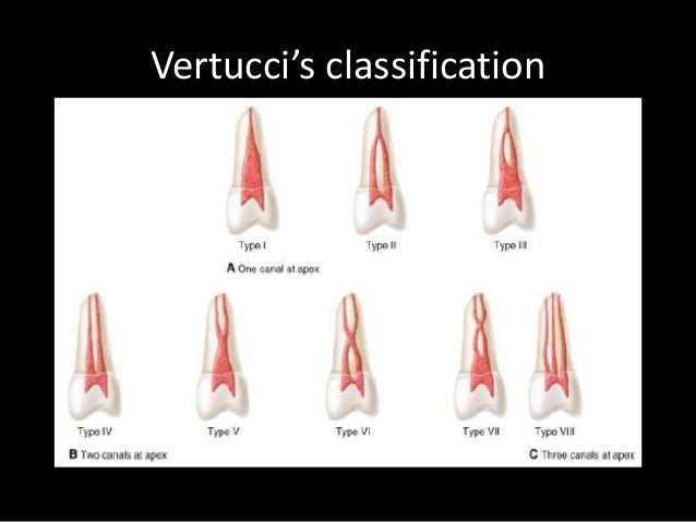Root canal morphology nidhi