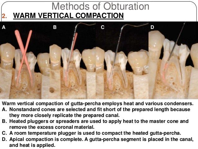 Root canal obturation timing materials and techniques