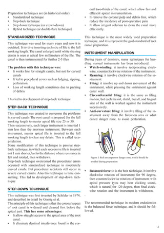 Root Canal Preparation Basics | PDF